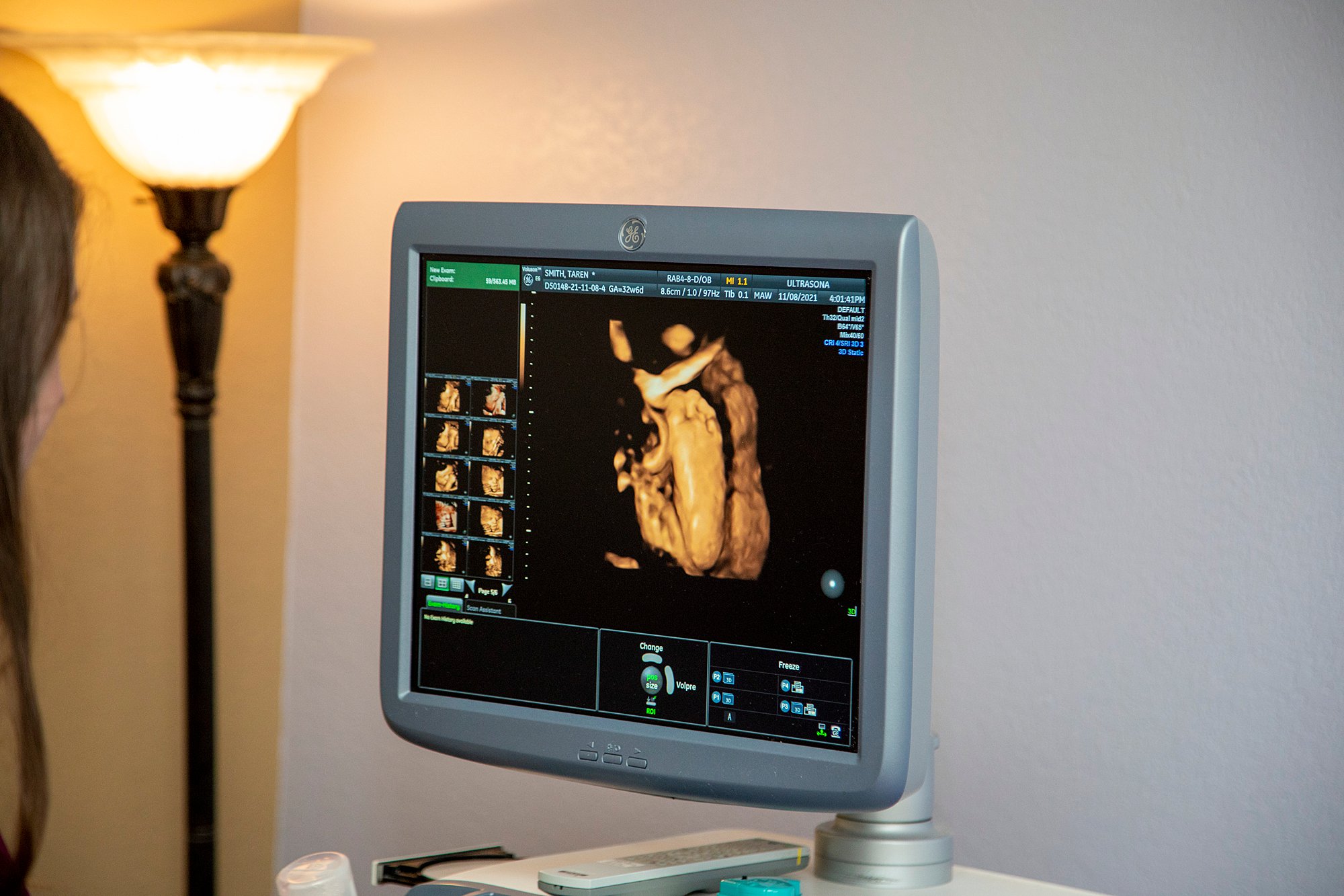 Fetal Development - Ultrasona - Springfield, MO