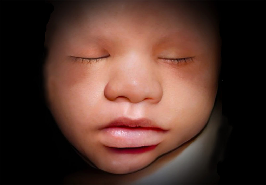 Ultrasona - 2D, 3D, 4D & HD Ultrasounds - Springfield, MO