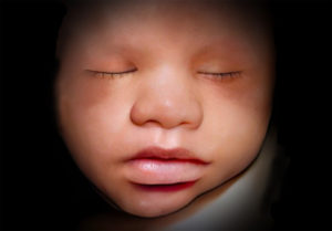 Ultrasona - 2D, 3D, 4D & HD Ultrasounds - Springfield, MO